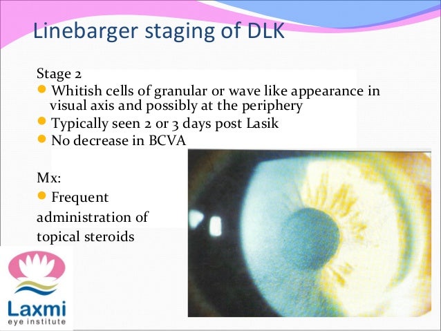 LASIK: COMPLICATIONS AND THEIR MANAGEMENT