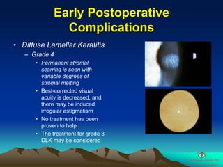 LASIK Complications.ppt
