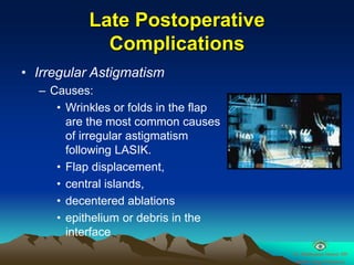 LASIK Complications.ppt