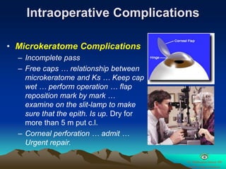 LASIK Complications.ppt