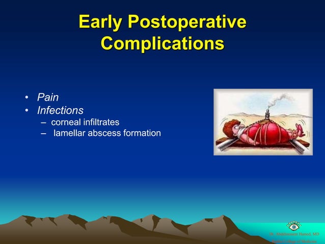 LASIK Complications.ppt | Eye and Vision Conditions | Diseases and ...