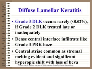 Lasik Complications 2001 Diffuse Lamellar Keratitis by Dr. Jeffery ...