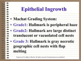 Lasik Complications 2001 Epithelial Ingrowth by Dr. Jeffery Machat | PDF