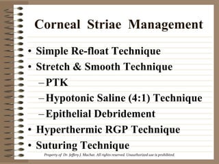 Lasik Complications 2001 Striae by Dr. Jeffery Machat | PDF
