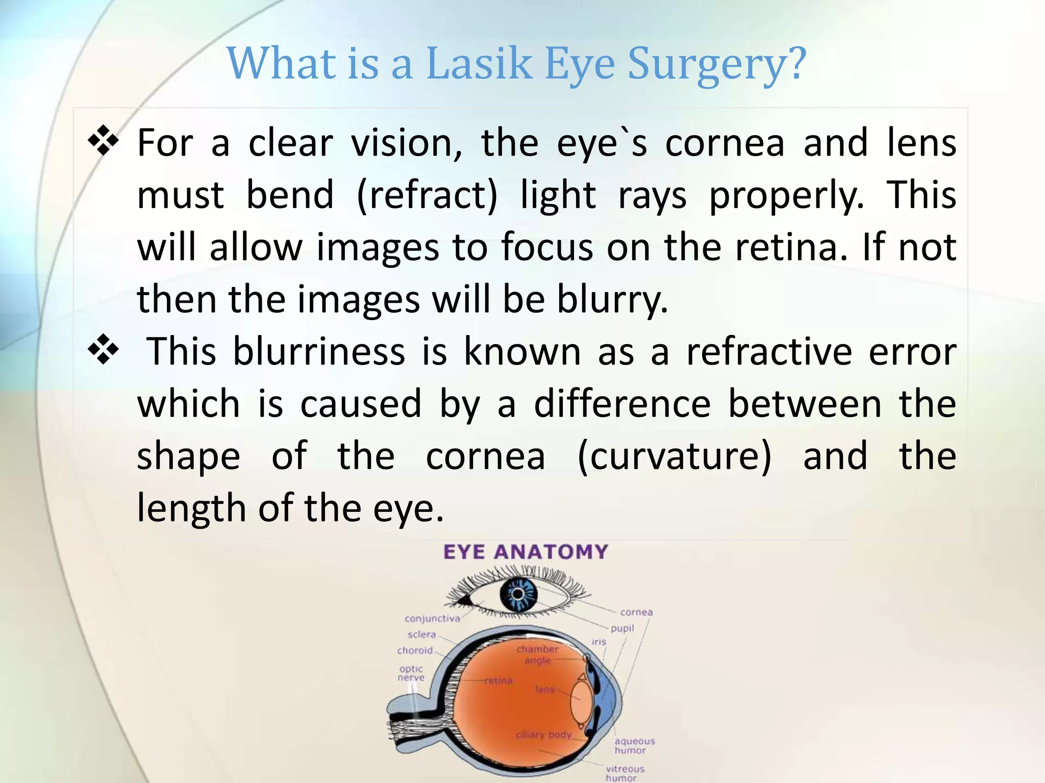 Lasik eye surgery | PPTX