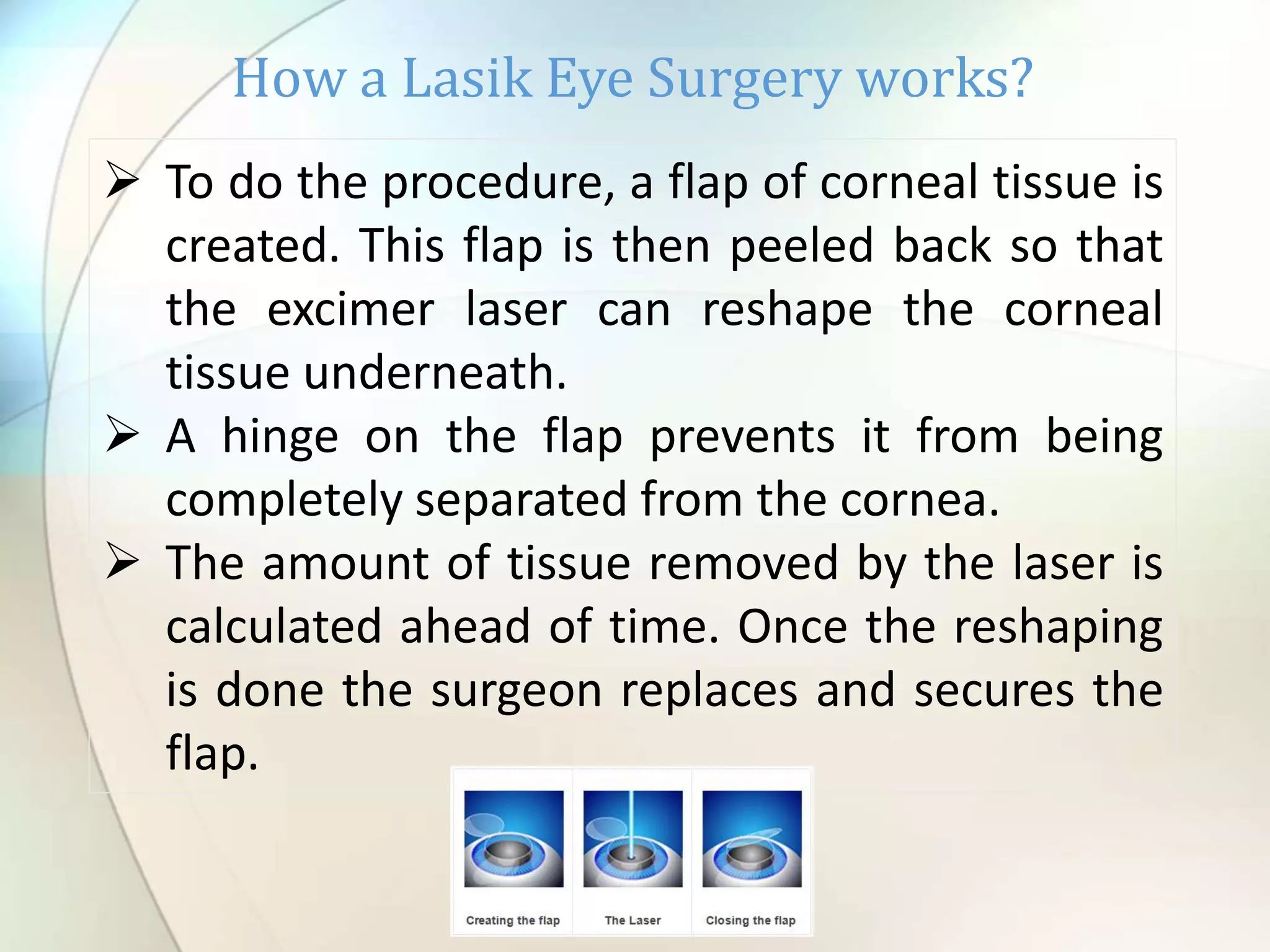 Lasik eye surgery | PPTX