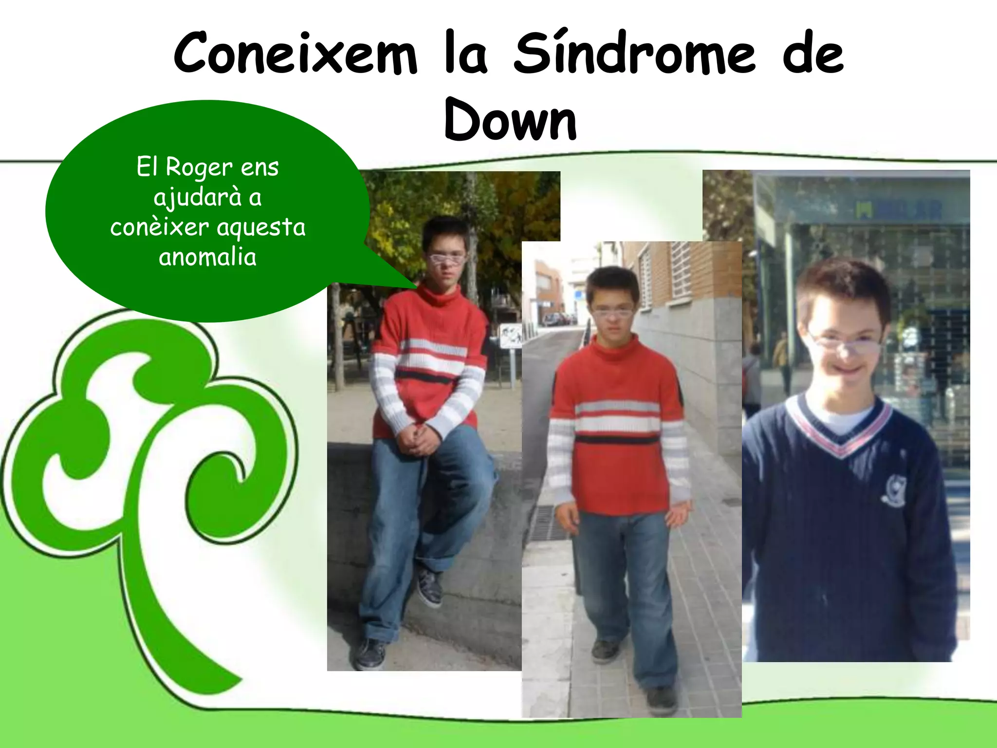 La sindrome de down | PPT