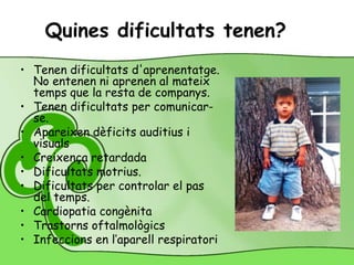 La sindrome de down | PPT