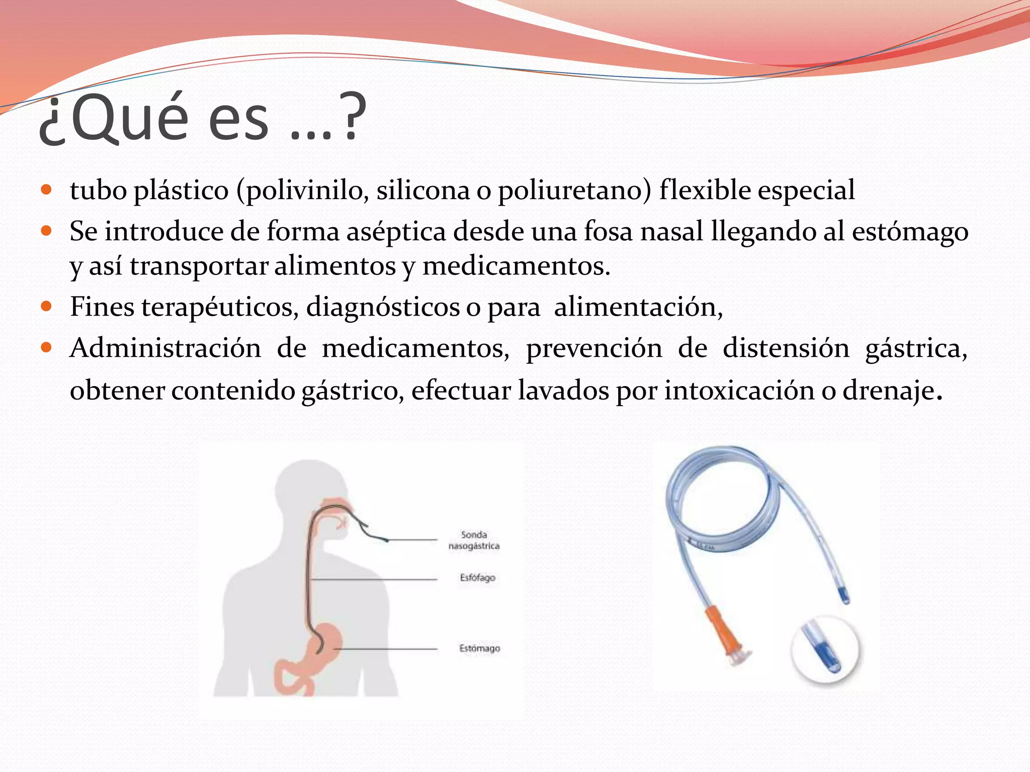 La sonda nasogastrica | PPTX