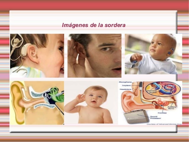 La sordera