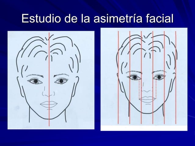 Las Proporciones Del Rostro Ortodoncia Ppsx