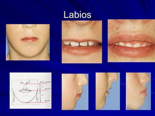 Las Proporciones Del Rostro Ortodoncia Kulturaupice