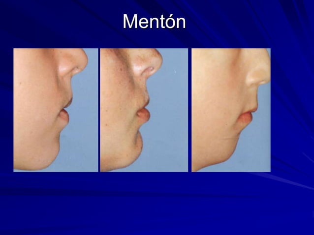 Las Proporciones Del Rostro Ortodoncia Kulturaupice