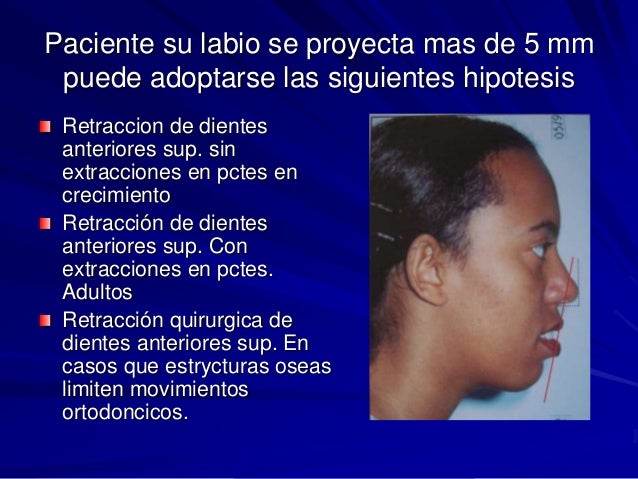 Las Proporciones Del Rostro Ortodoncia Kulturaupice
