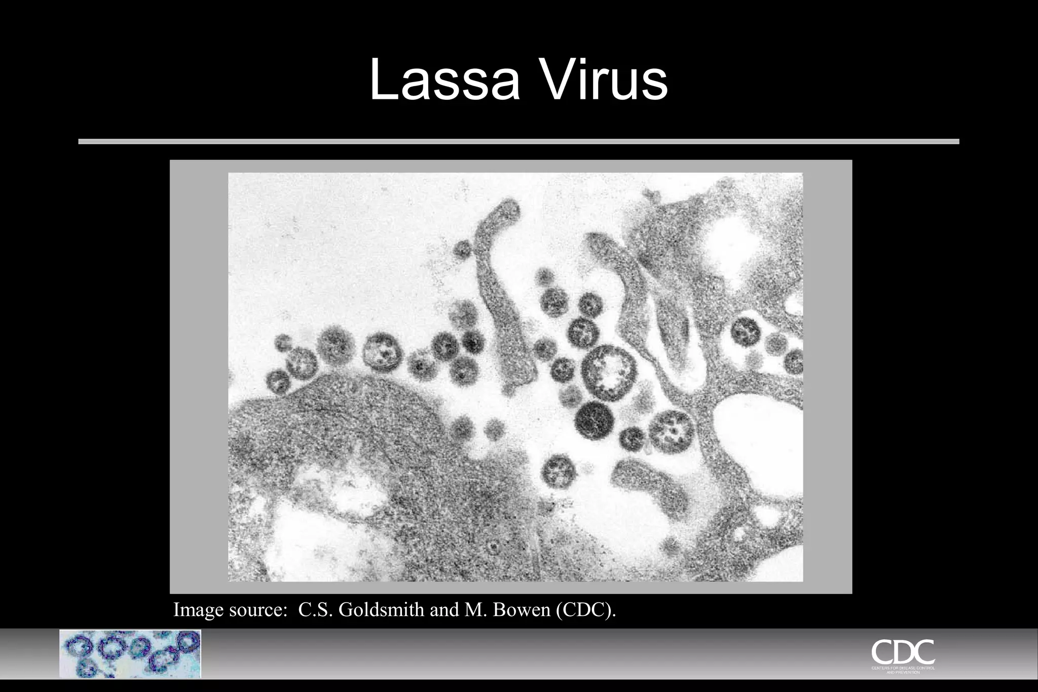 Lassa fever | PPT