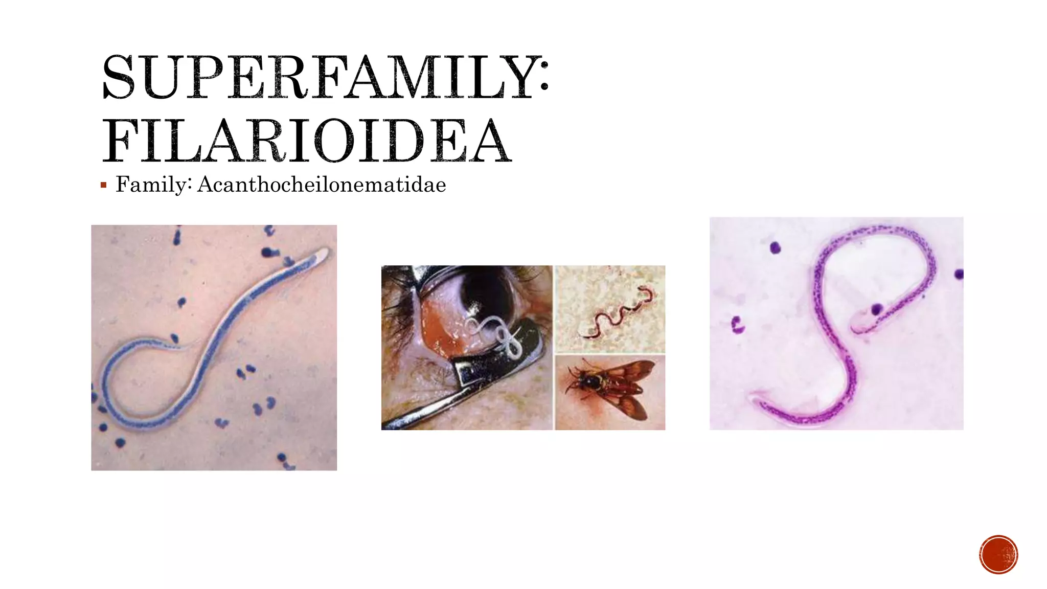 Introduction to Tissue Nematodes and Filarial Worms | PPTX