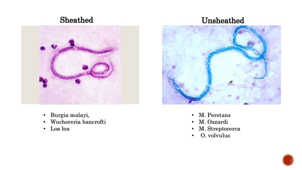 Introduction to Tissue Nematodes and Filarial Worms