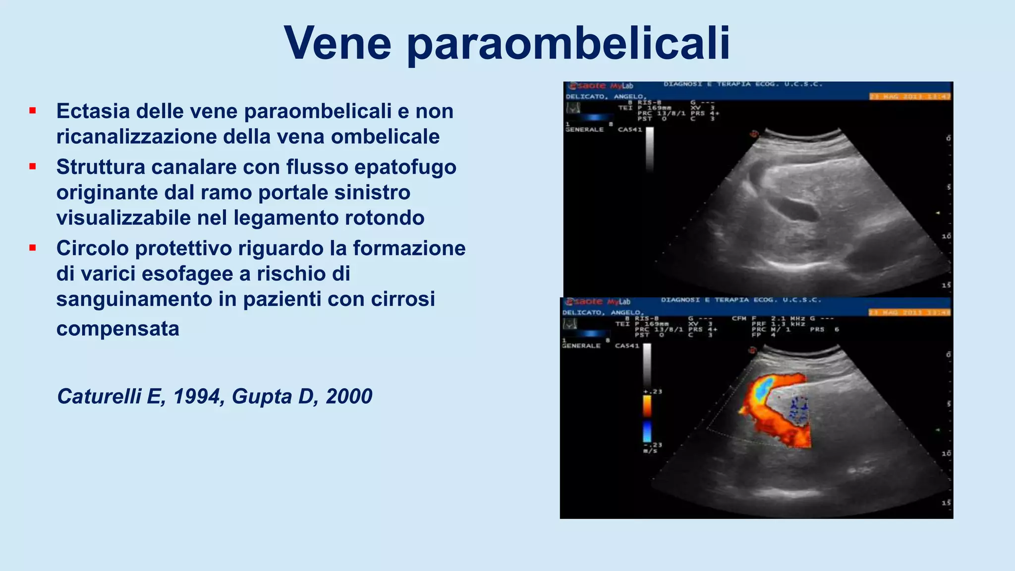 L’ecografia nell’ambulatorio dell’Epatologo | PPTX