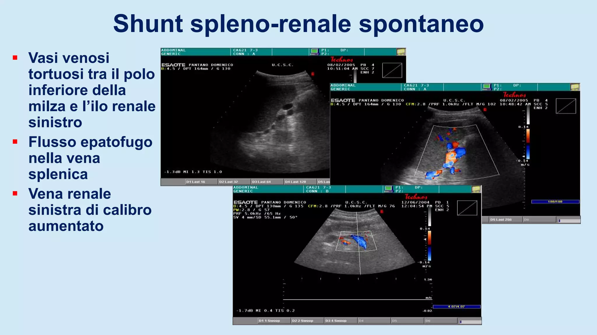 L’ecografia nell’ambulatorio dell’Epatologo | PPTX