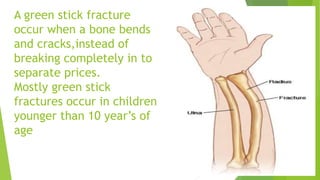 last full ppt fracture....' with you' with you.pptx