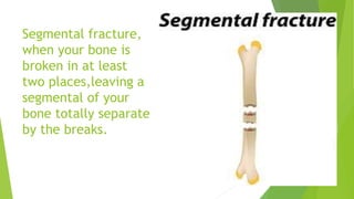 last full ppt fracture....' with you' with you.pptx