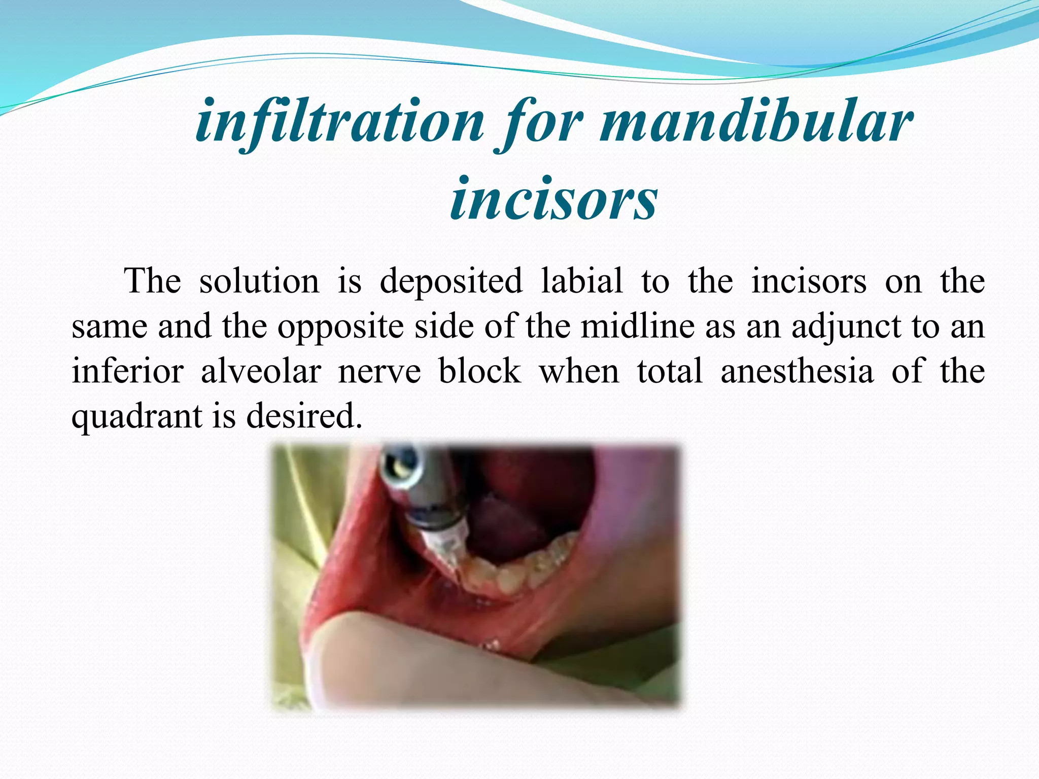 Local Anesthesia and Pain Control Pediatric Dentistry by Dr. Ahmed Sami ...