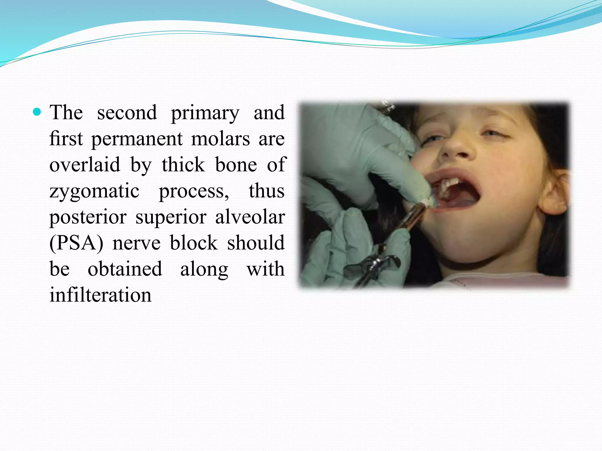 Local Anesthesia and Pain Control Pediatric Dentistry by Dr. Ahmed Sami ...