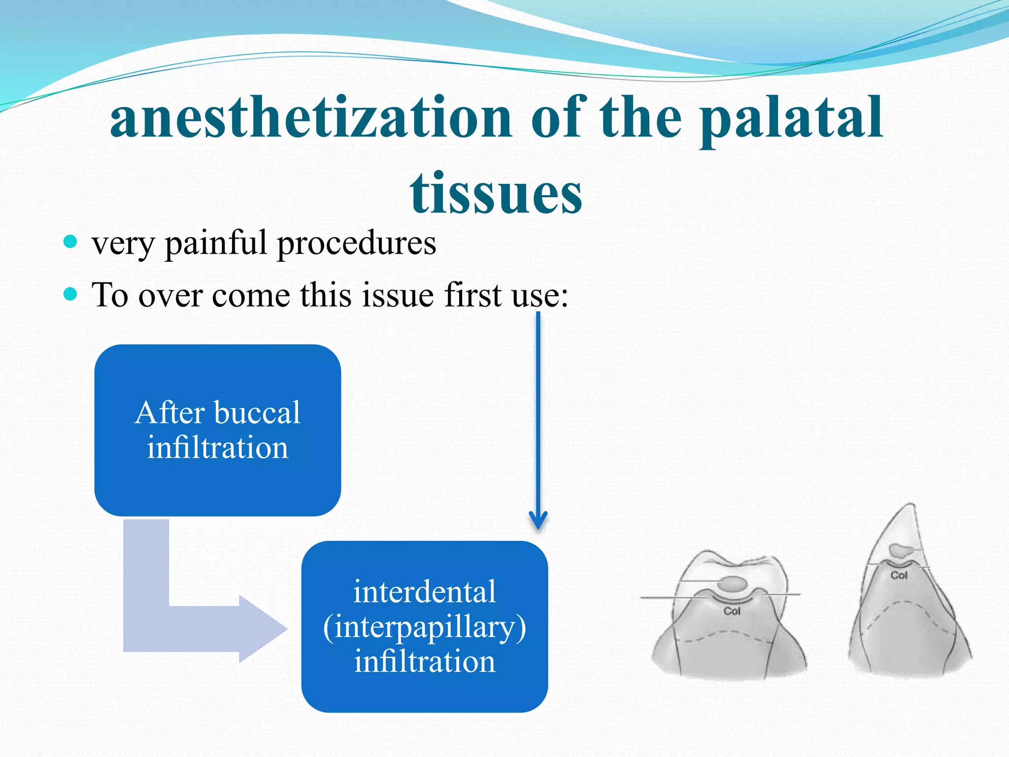 Local Anesthesia and Pain Control Pediatric Dentistry by Dr. Ahmed Sami ...