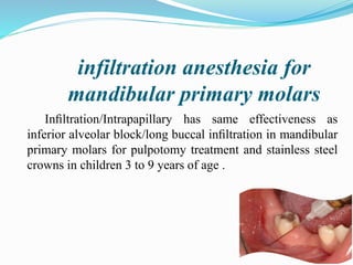 Local Anesthesia and Pain Control Pediatric Dentistry by Dr. Ahmed Sami ...