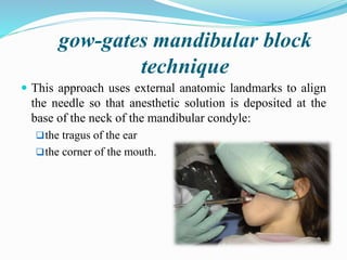 Local Anesthesia and Pain Control Pediatric Dentistry by Dr. Ahmed Sami ...