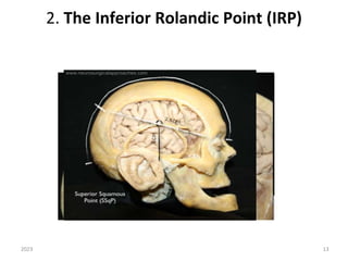 last update craniometric point of surgical importance.ppsx