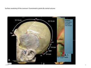 last update craniometric point of surgical importance.ppsx