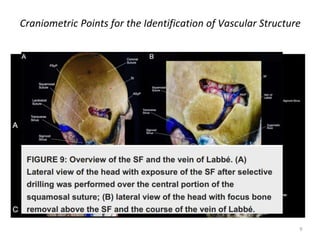 last update craniometric point of surgical importance.ppsx