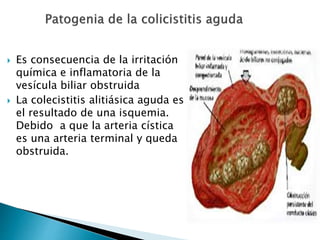 Las vías biliares presentacion ana | PPTX