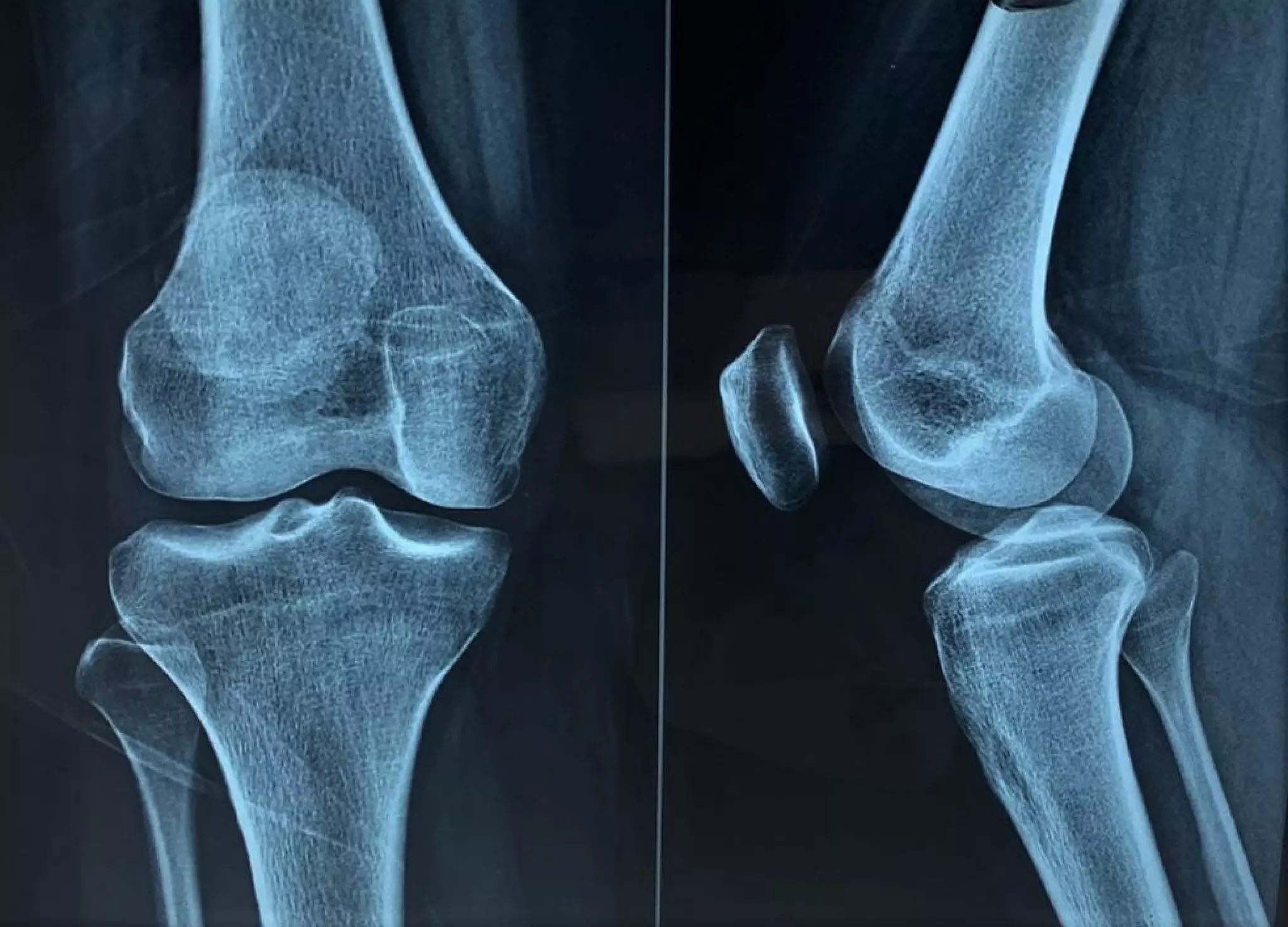 Knee lateral view | PPT