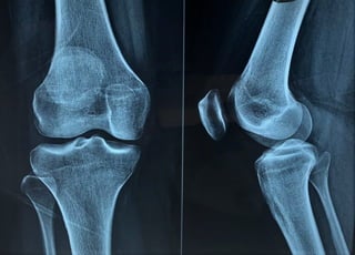 Knee lateral view | PPT