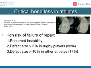 Latarjet Indications for Shoulder Dislocations and Instability in ...