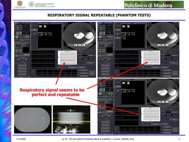 4DCT using Optical Tracking Device | PPT