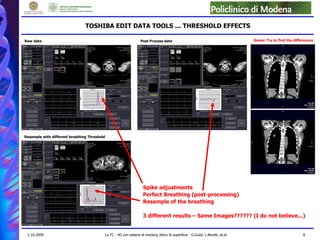 4DCT using Optical Tracking Device | PPT