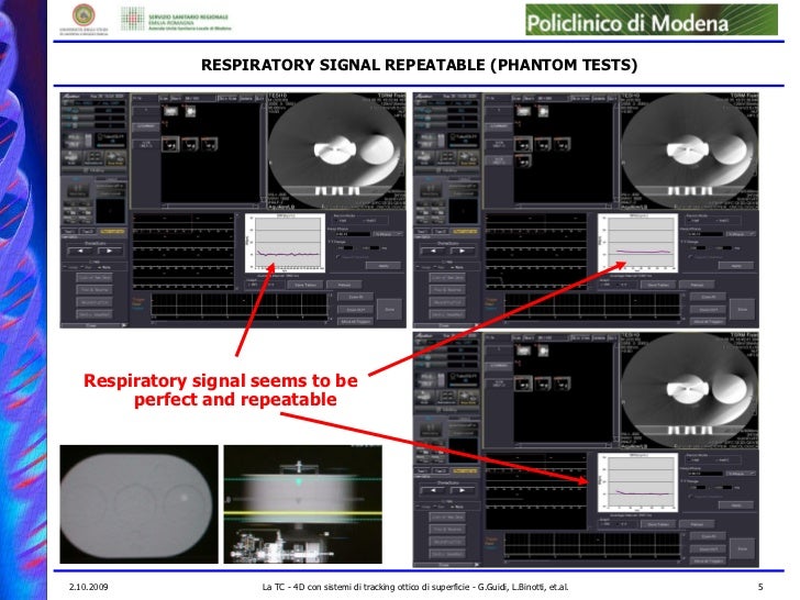 4DCT with Optical Tracking Systems
