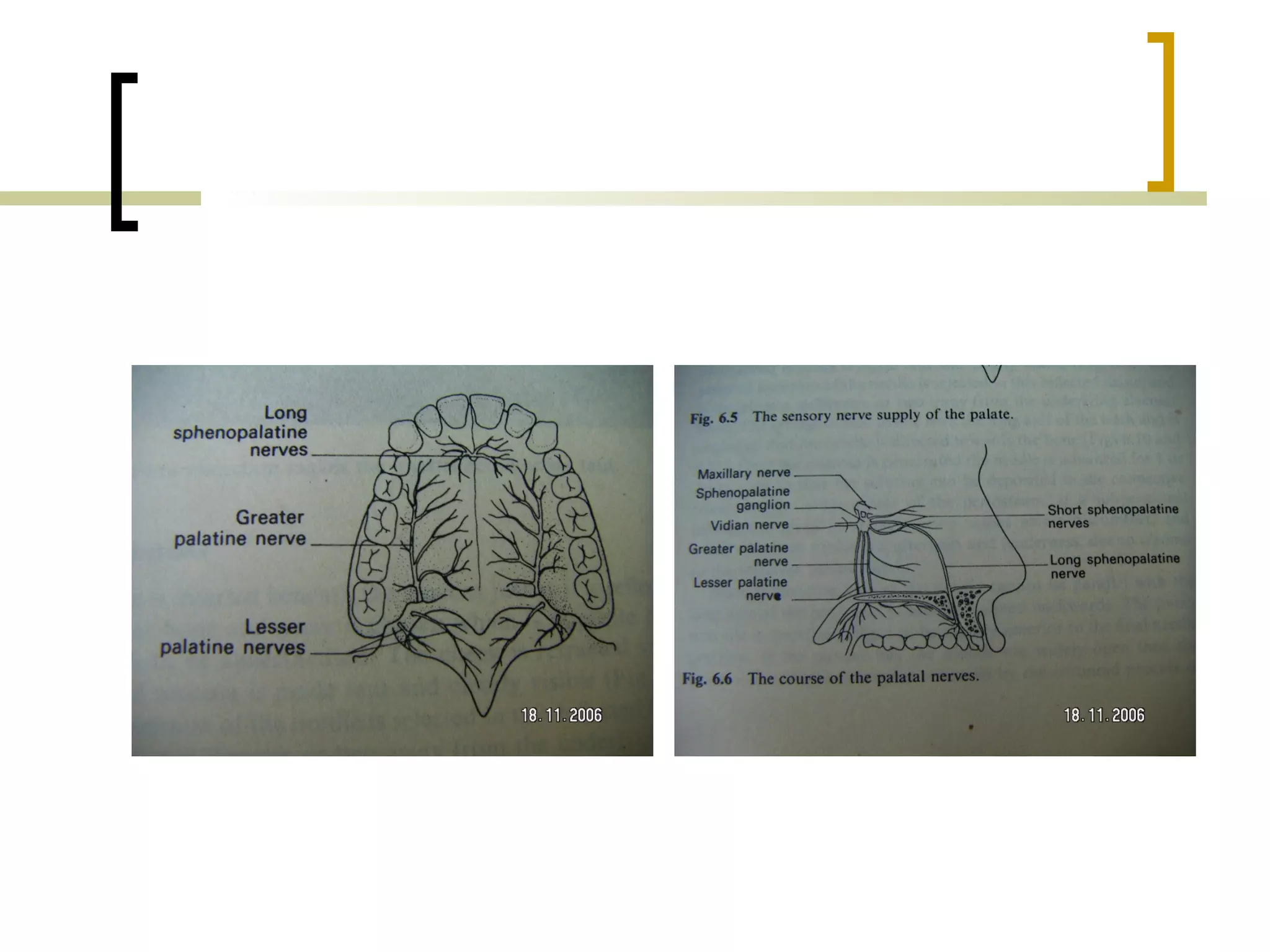 Local Anesthesia Injection Technique | PPT