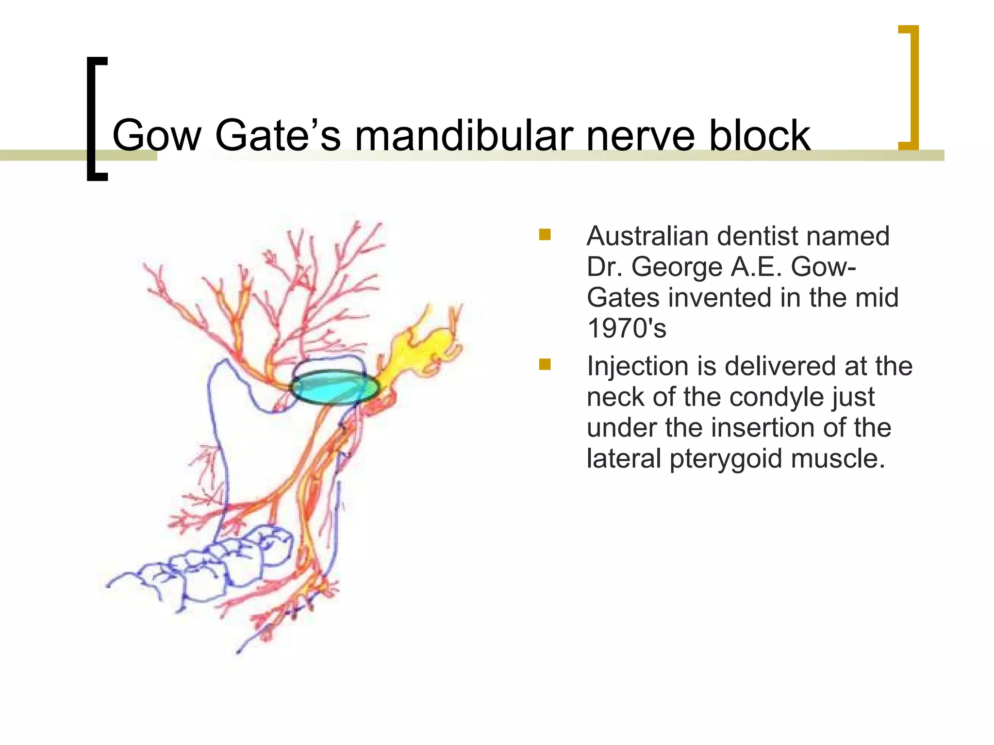 Local Anesthesia Injection Technique | PPT