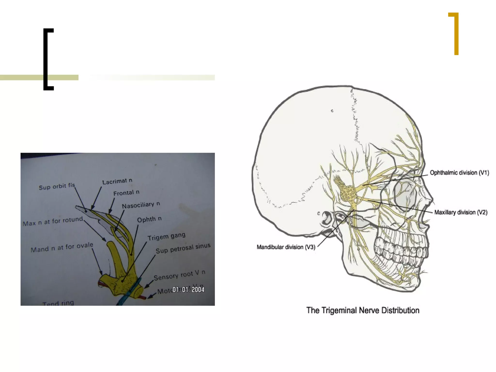 Local Anesthesia Injection Technique | PPT