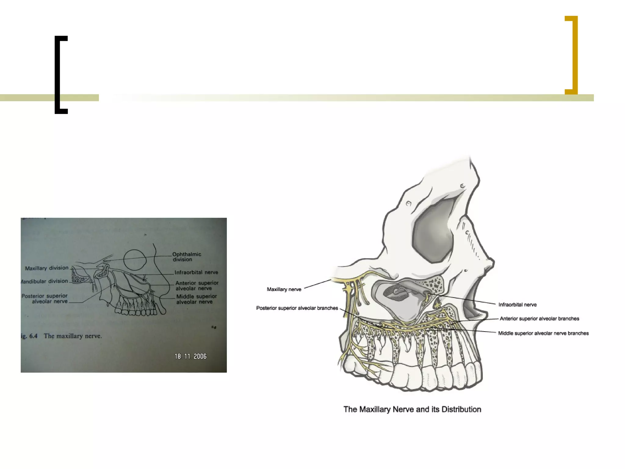 Local Anesthesia Injection Technique | PPT