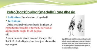 Local anesthesia Techniques in Surgery pptx | PPTX | Brain and Nervous ...