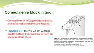 Local anesthesia Techniques in Surgery pptx | PPTX | Brain and Nervous ...