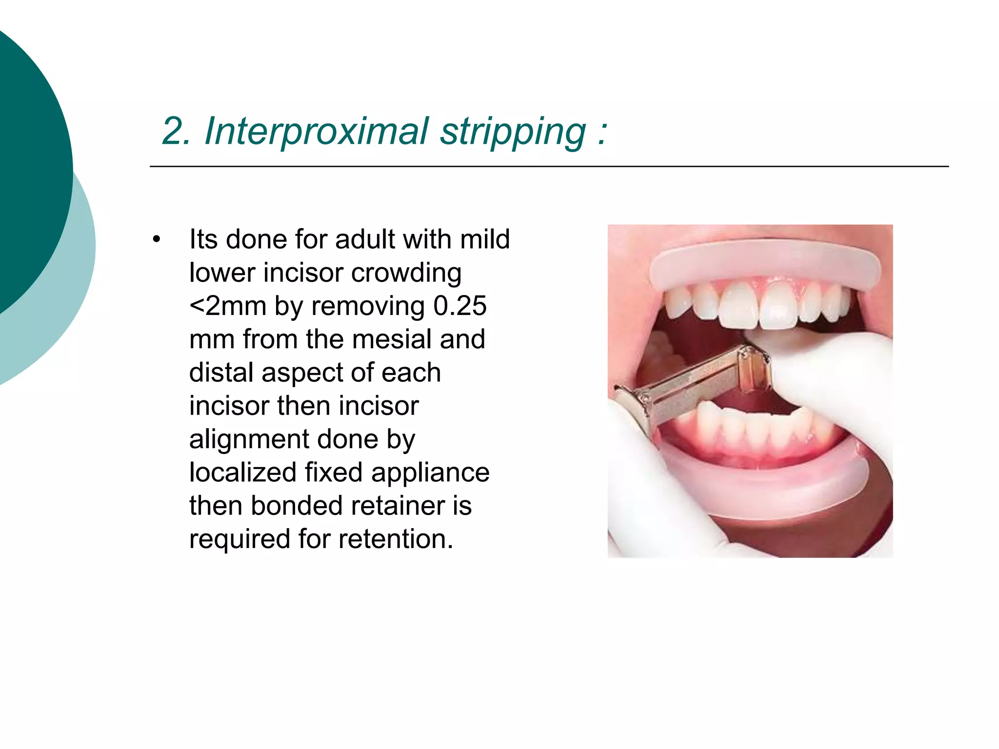 Late mandibular incisor crowding | PPT | Dental Health | Diseases and ...