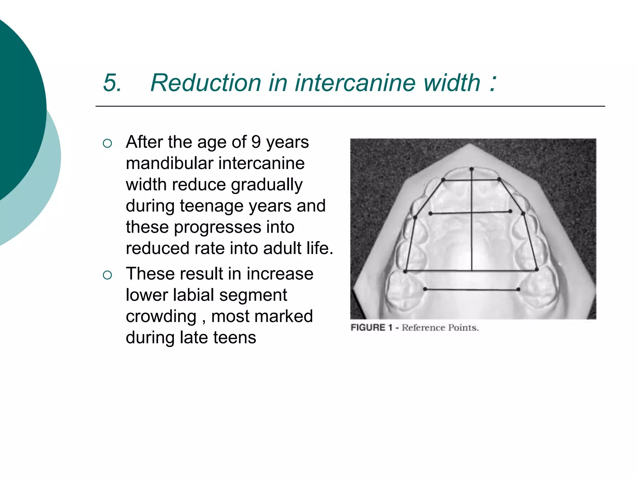 Late mandibular incisor crowding | PPT