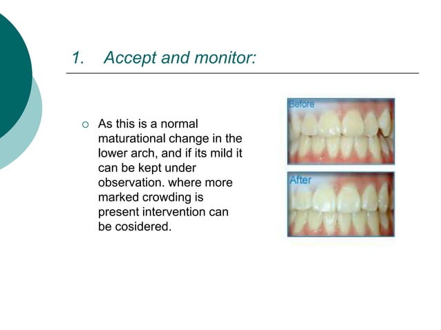 Late mandibular incisor crowding | PPT | Dental Health | Diseases and ...