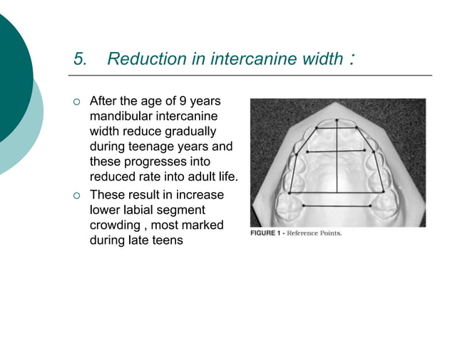 Late mandibular incisor crowding | PPT | Dental Health | Diseases and ...